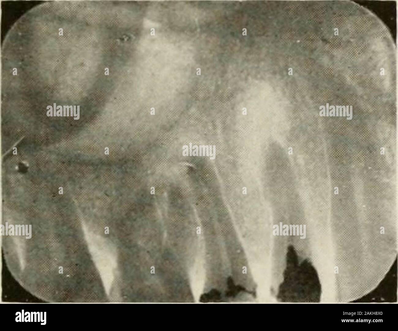 Apical Foramen High Resolution Stock Photography and Images - Alamy