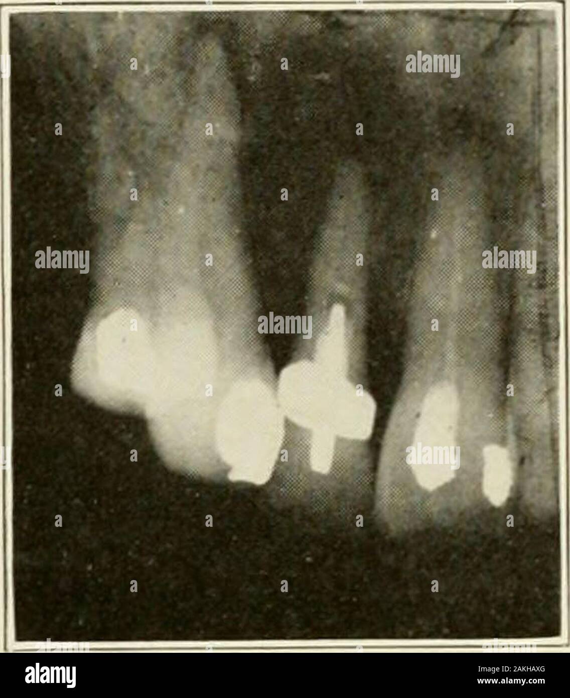 Silver nitrate process hi-res stock photography and images - Alamy