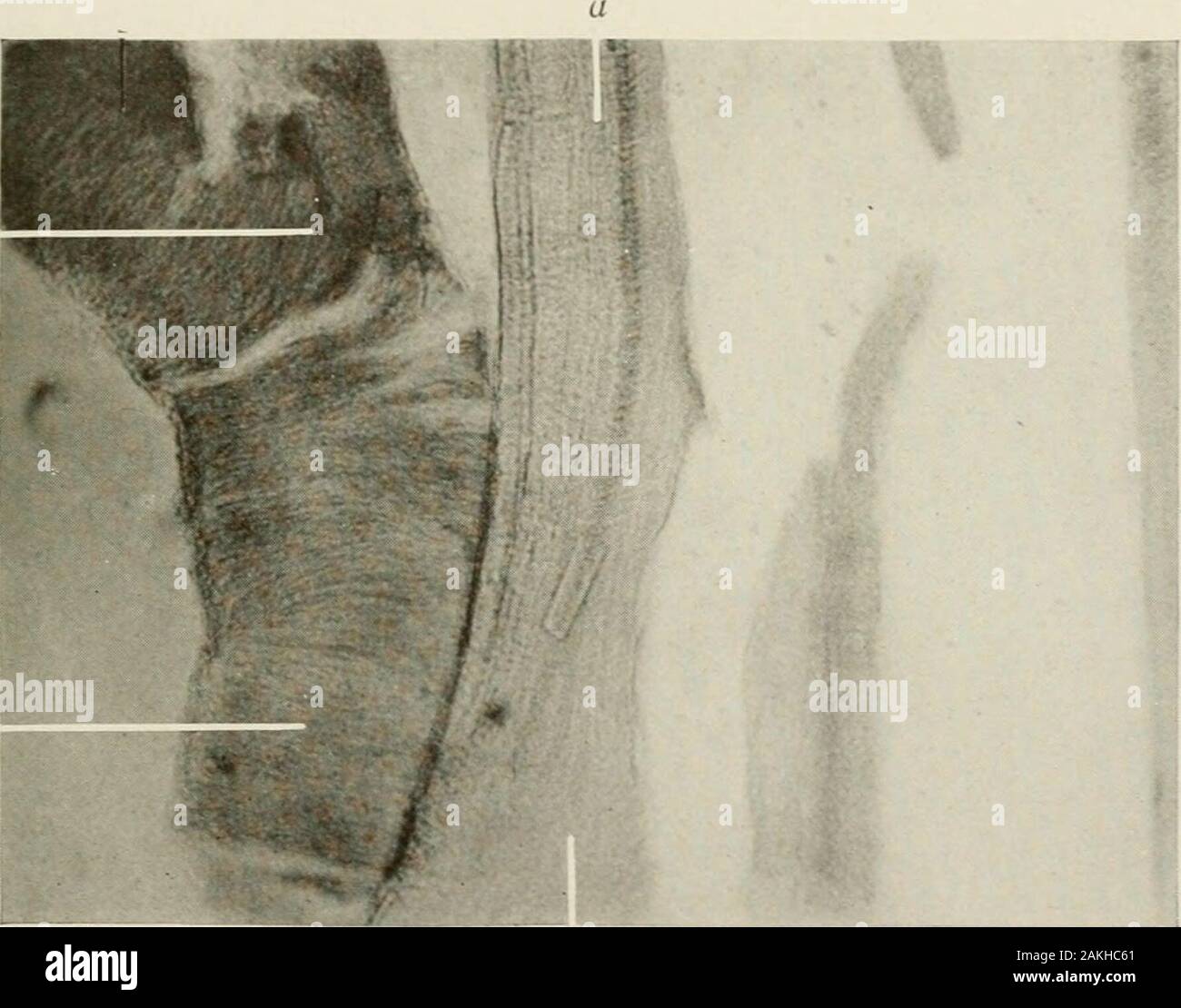 General and dental pathology with special reference to etiology and ...