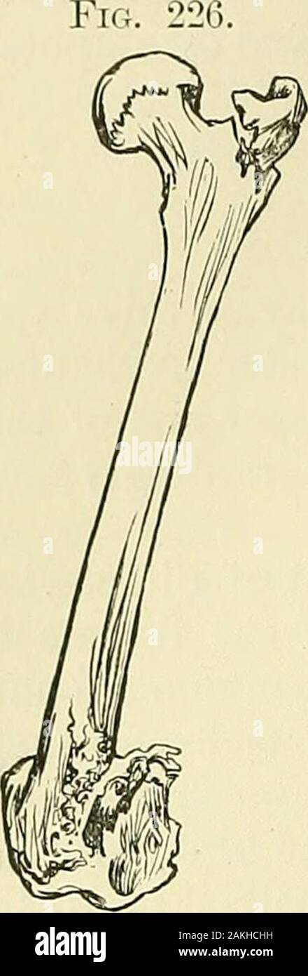 Envelopment hi-res stock photography and images - Alamy