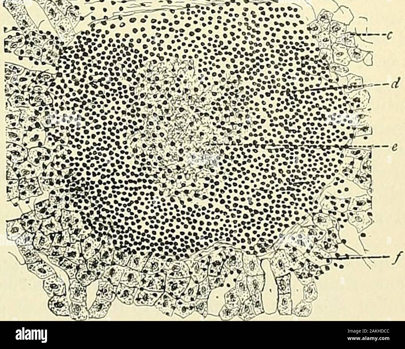 Gummatous syphilis hi-res stock photography and images - Alamy
