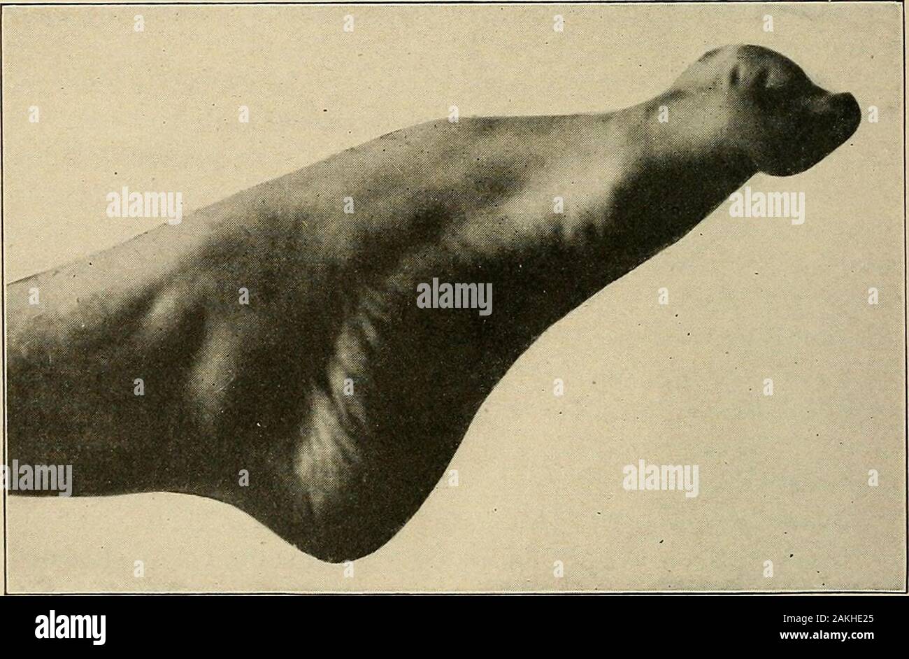 Diseases of the nervous system : a text-book of neurology and ...