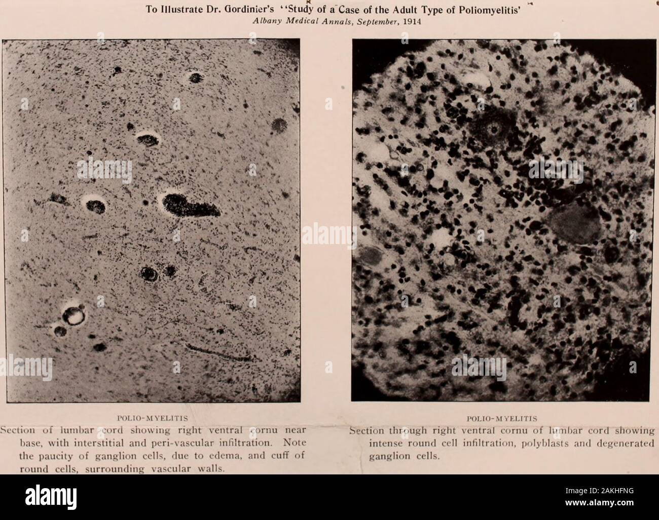 Ovoid bodies hi-res stock photography and images - Alamy