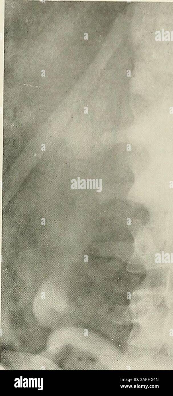 Narrowing abdomen hi-res stock photography and images - Alamy