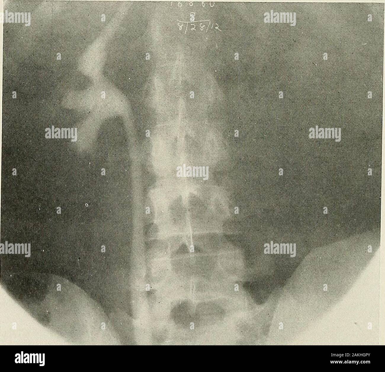 Narrowing abdomen hi-res stock photography and images - Alamy