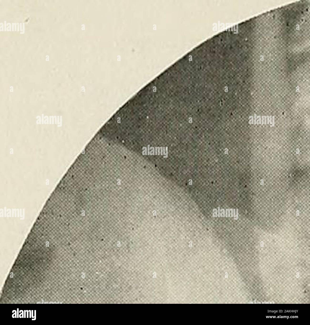 Pyelography (pyelo-ureterography) a study of the normal and pathologic ...