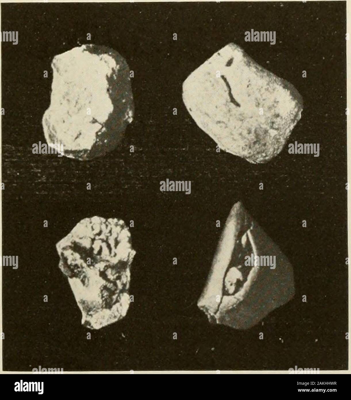 General and dental pathology with special reference to etiology and ...