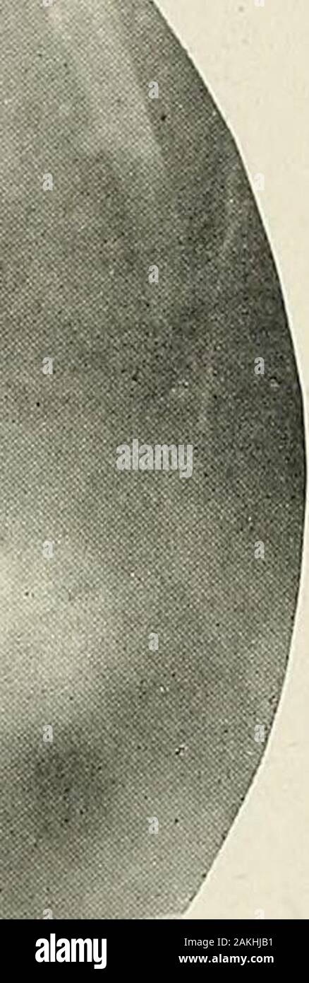 Pyelography (pyelo-ureterography) a study of the normal and pathologic ...