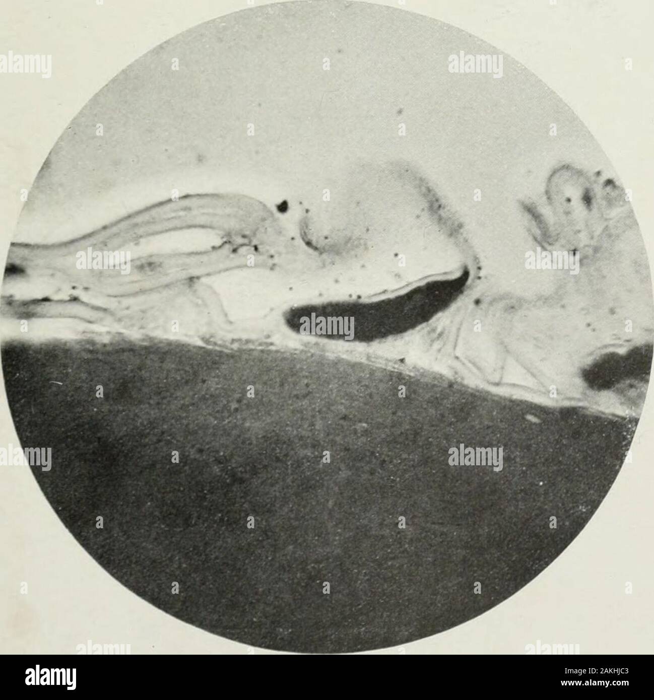 Dislocation lens hi-res stock photography and images - Alamy