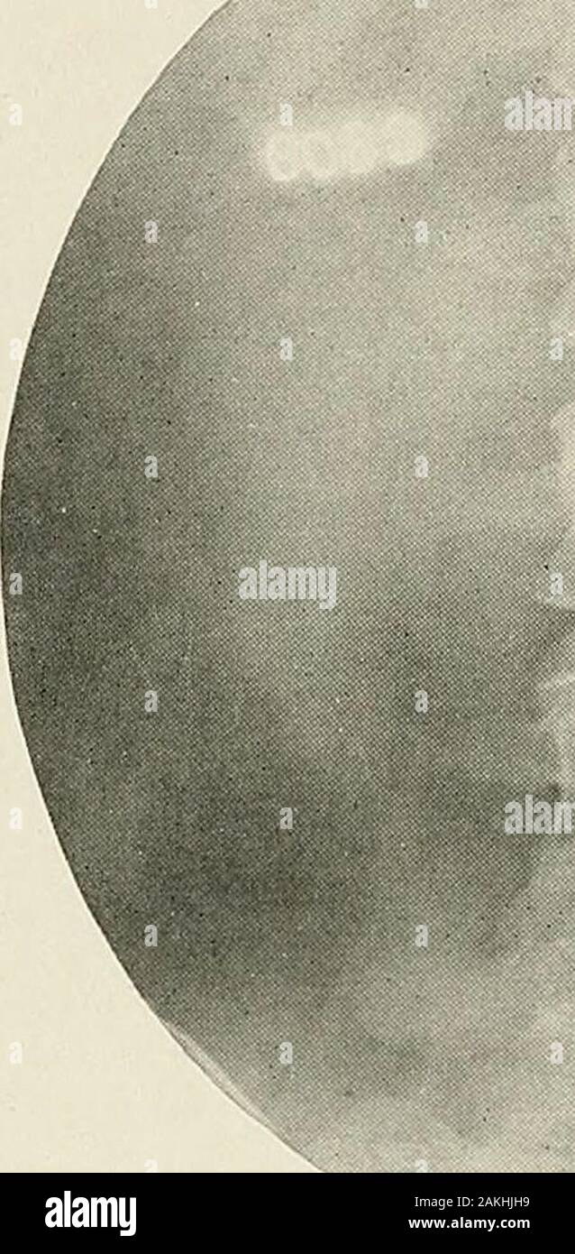 Pyelography (pyelo-ureterography) a study of the normal and pathologic ...