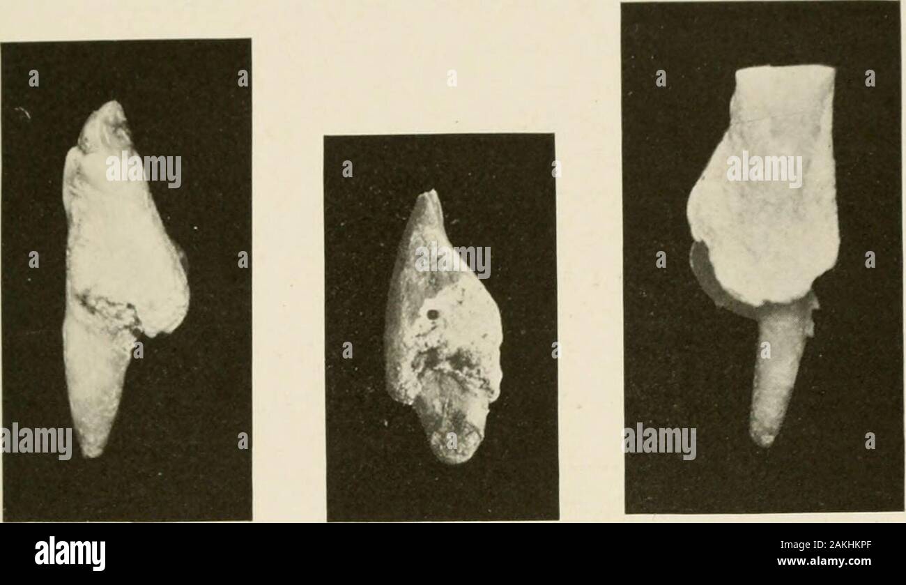 General and dental pathology with special reference to etiology and ...
