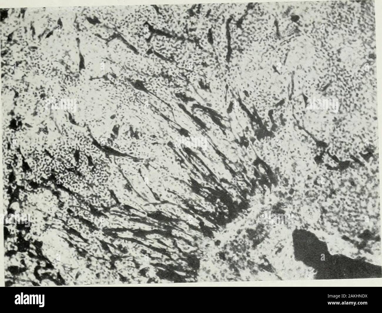 Syphilis study hi-res stock photography and images - Alamy