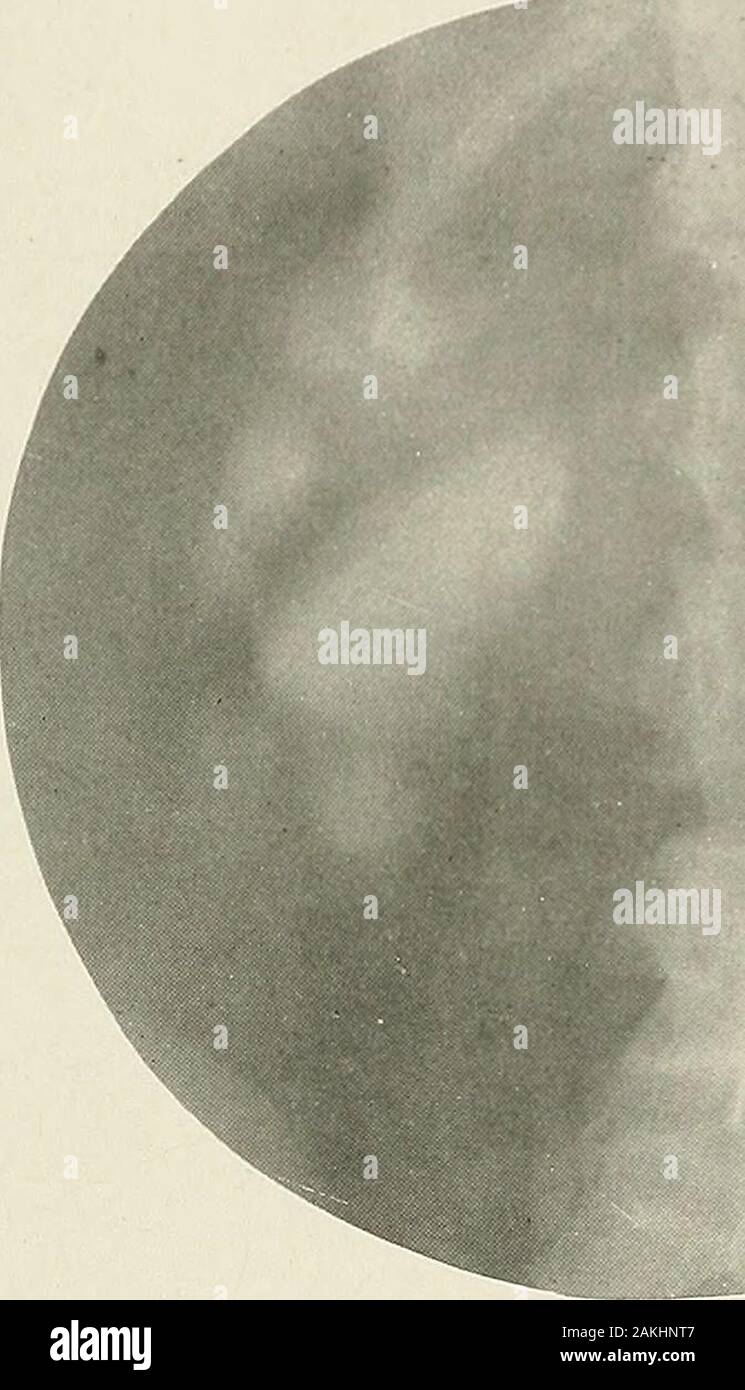 Pyelography (pyelo-ureterography) a study of the normal and pathologic ...