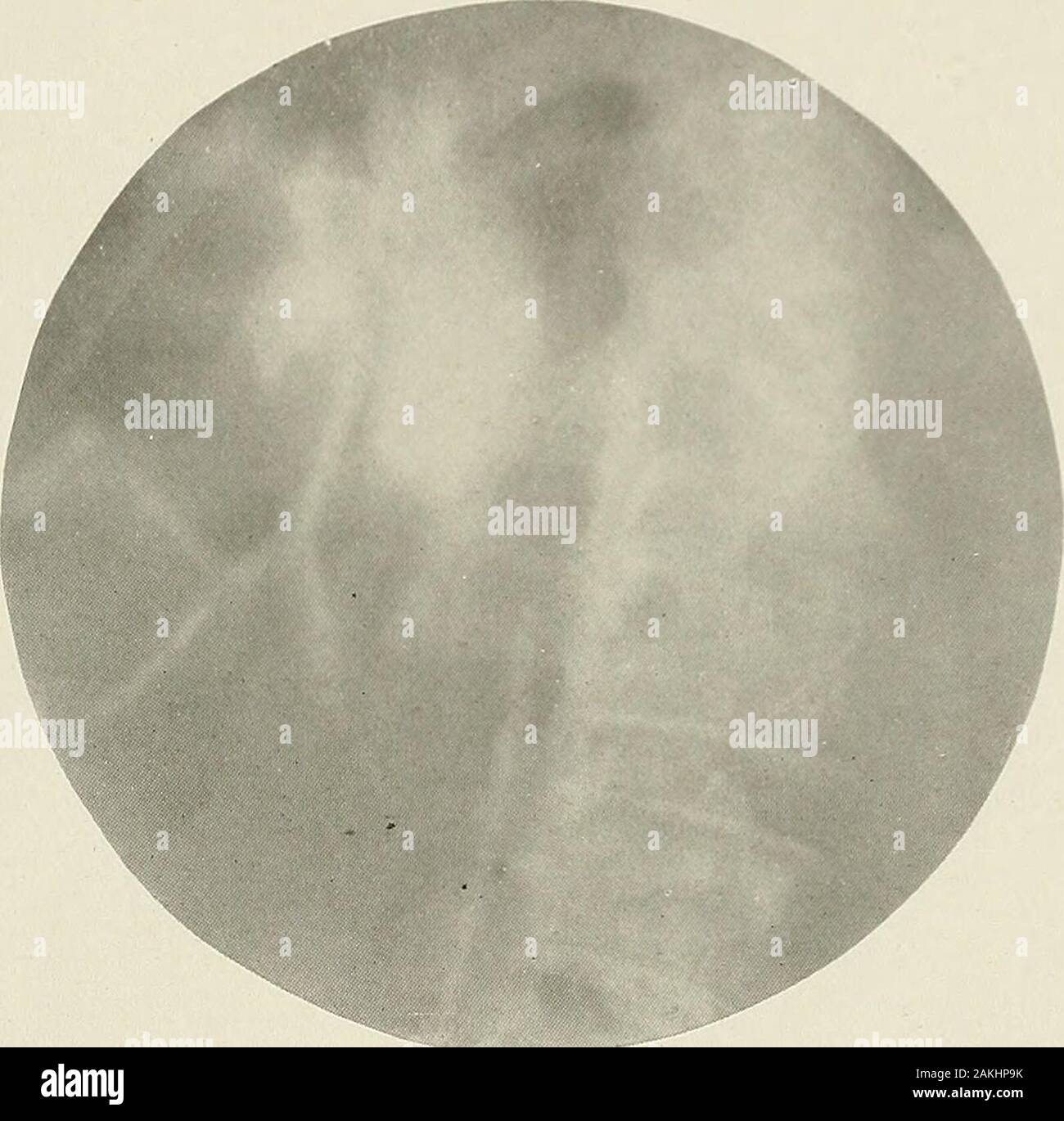 Pyelography (pyelo-ureterography) a study of the normal and pathologic ...