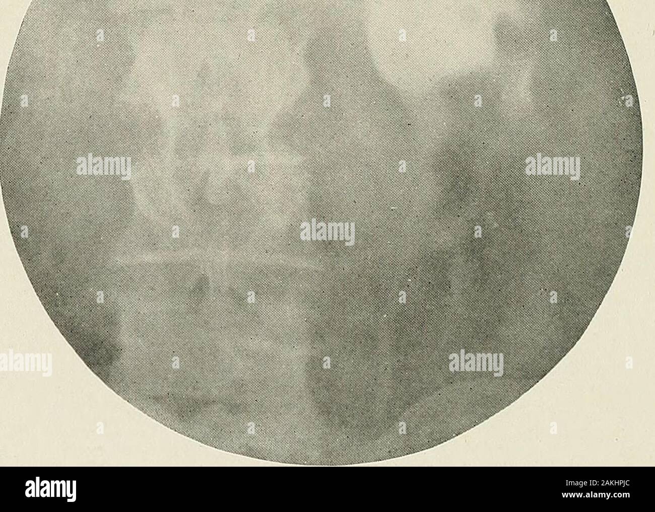 Pyelography (pyelo-ureterography) a study of the normal and pathologic ...