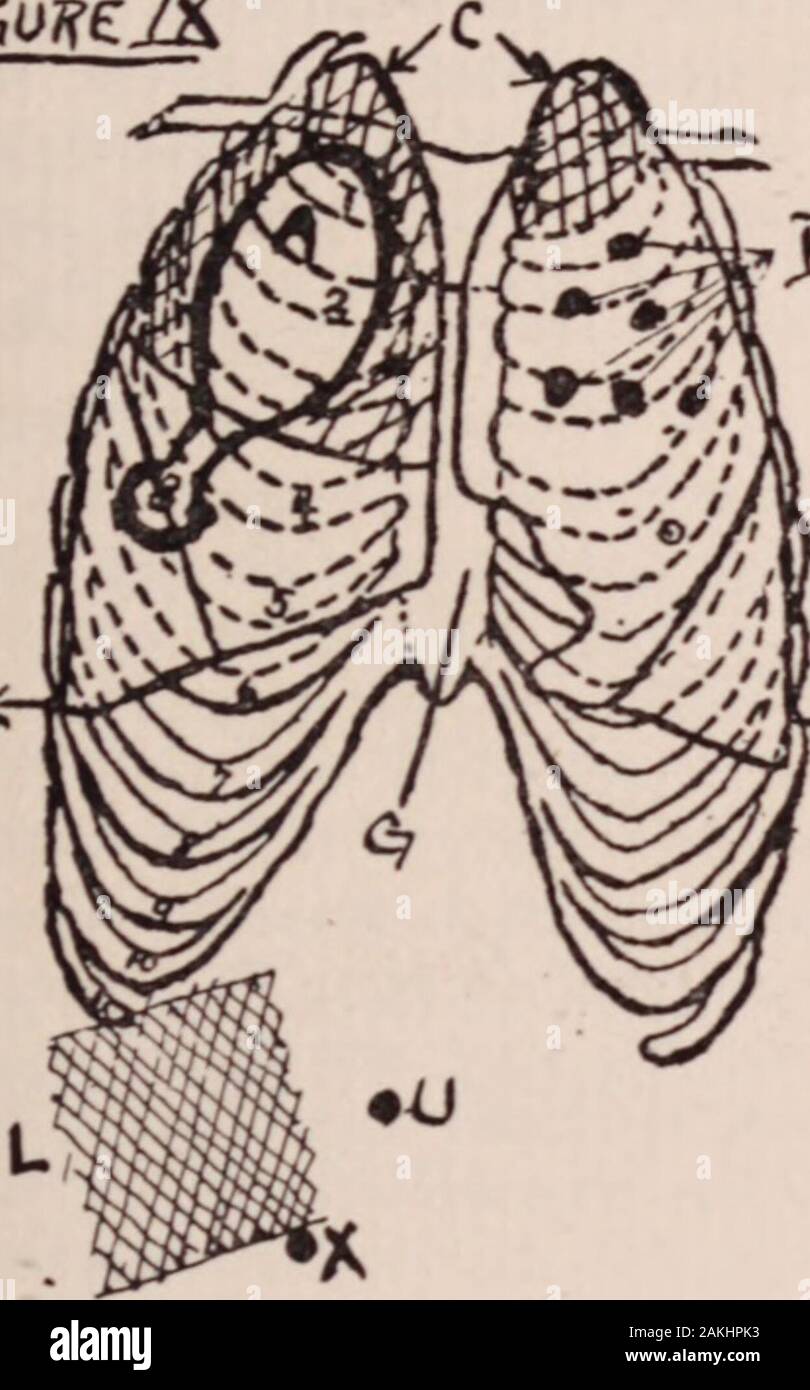 Albany medical annals . om the second rib to the costal margin therewas ...