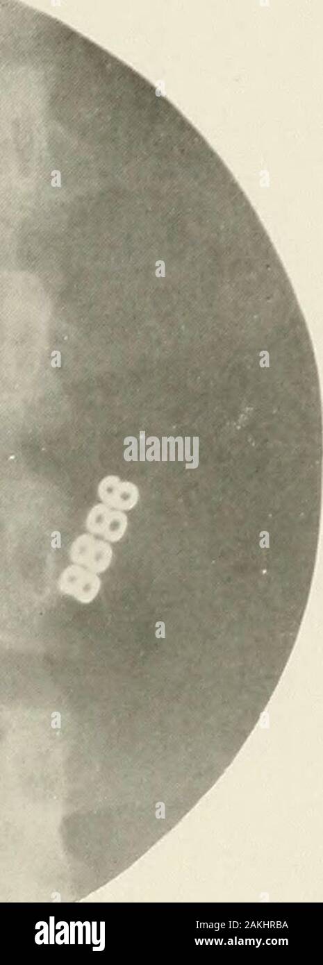 Pyelography (pyelo-ureterography) a study of the normal and pathologic ...