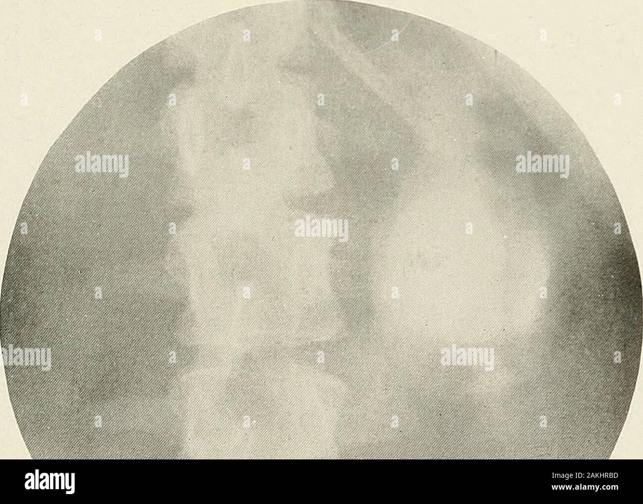 Pyelography (pyelo-ureterography) a study of the normal and pathologic ...