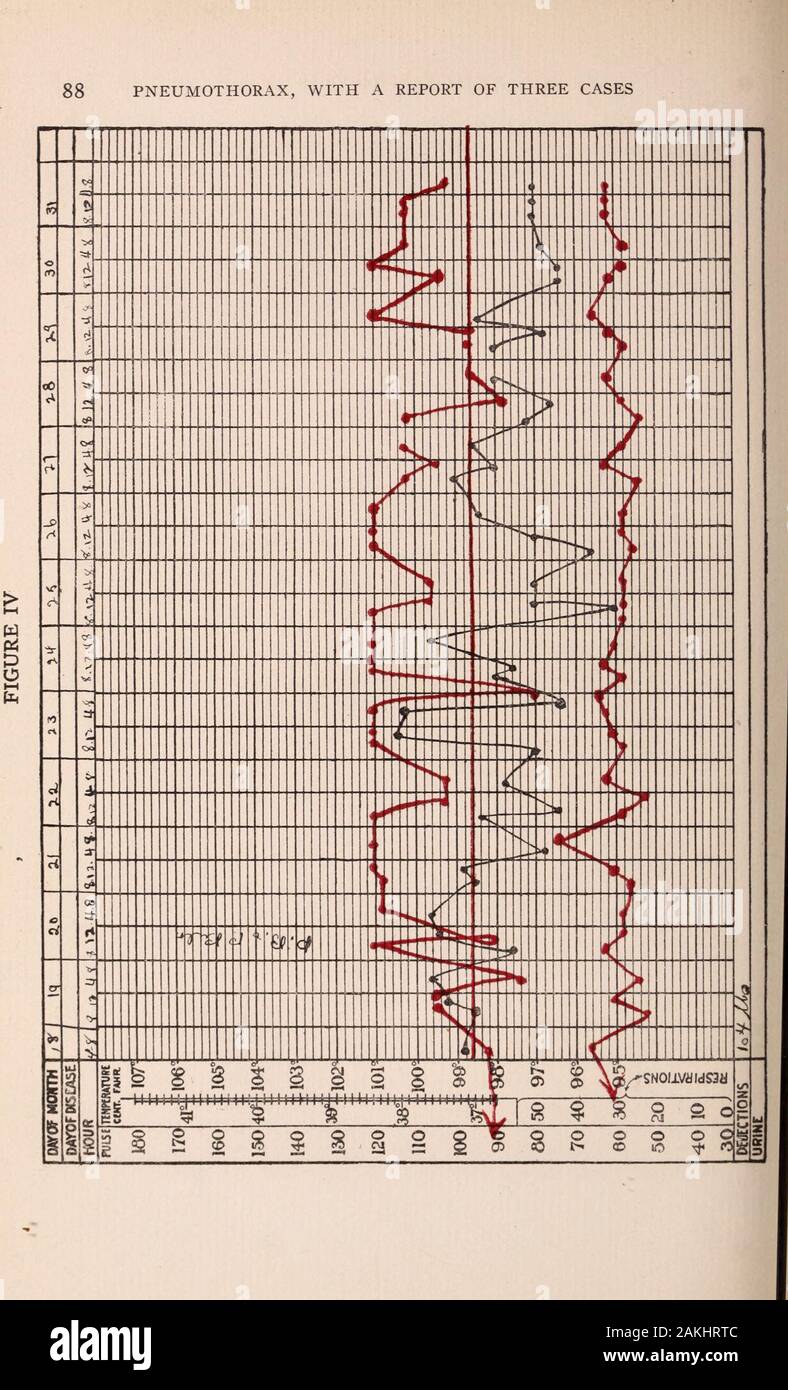 Albany medical annals . A=Area of cardiac dulness.B=Normal resonance.C ...