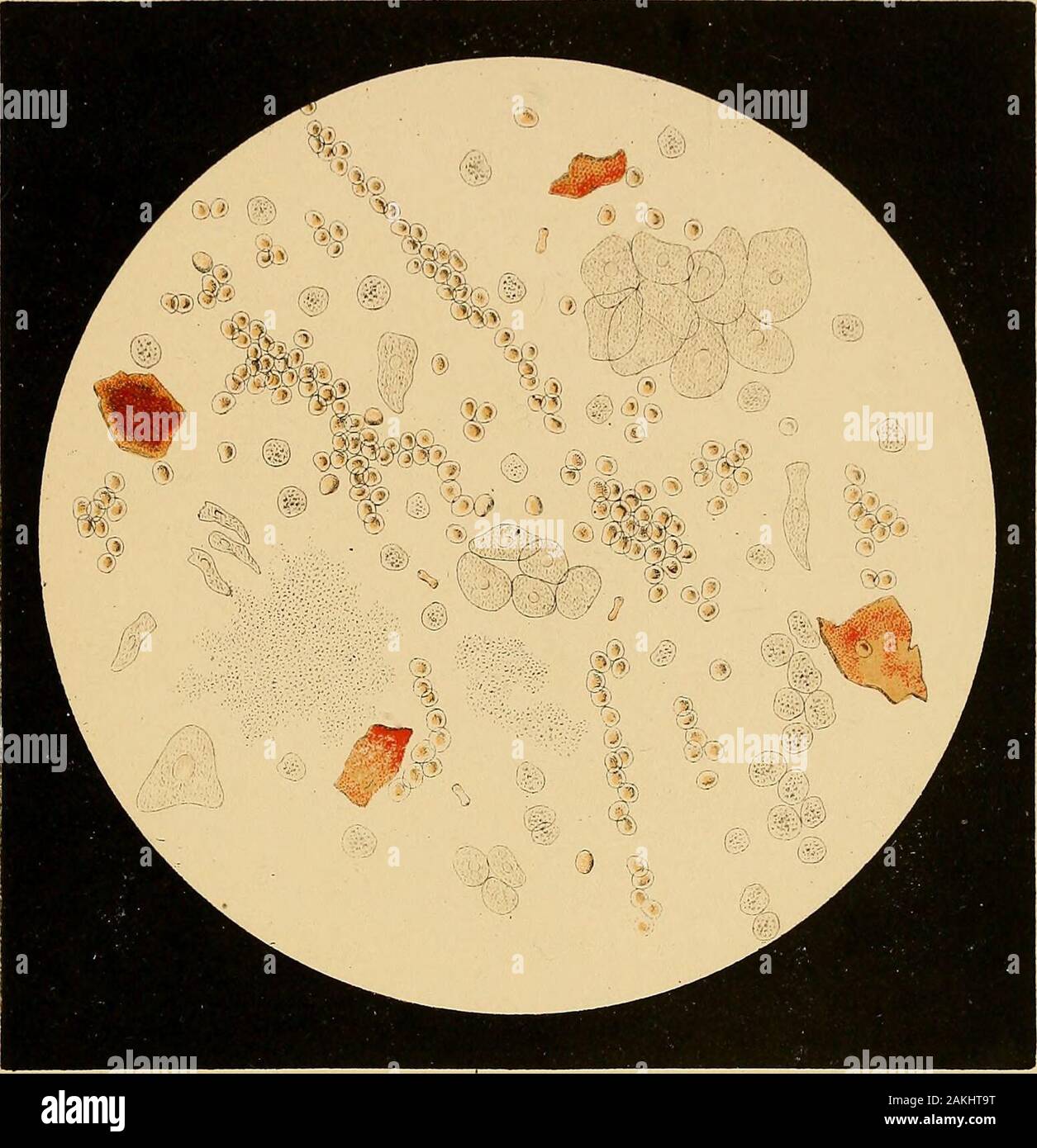 An atlas of clinical microscopy . s sufiicient for the diagnosis to ...