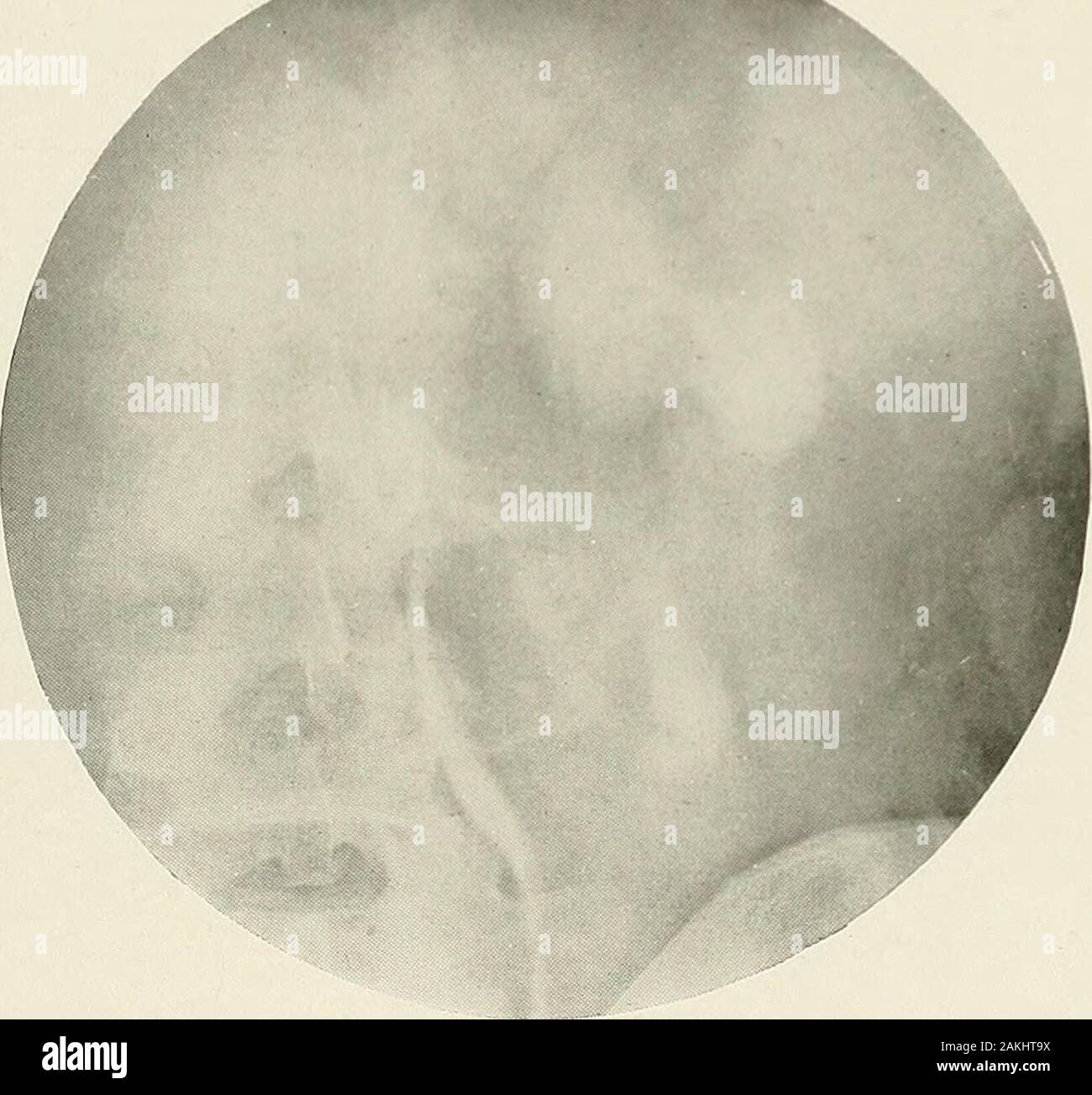 Pyelography (pyelo-ureterography) a study of the normal and pathologic ...