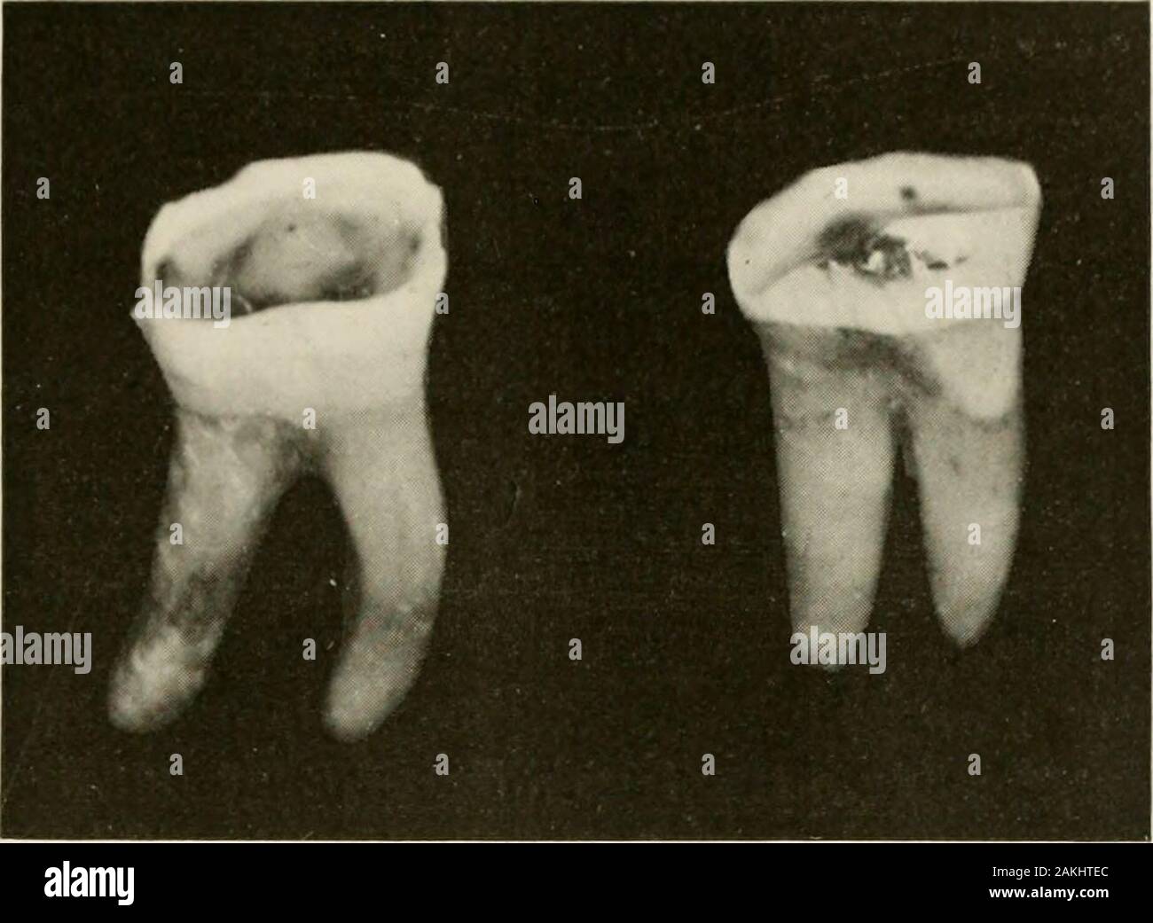 The first kidneys hi-res stock photography and images - Alamy