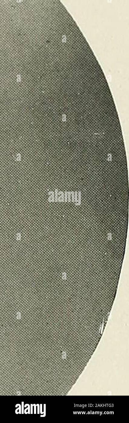 Pyelography (pyelo-ureterography) a study of the normal and pathologic ...