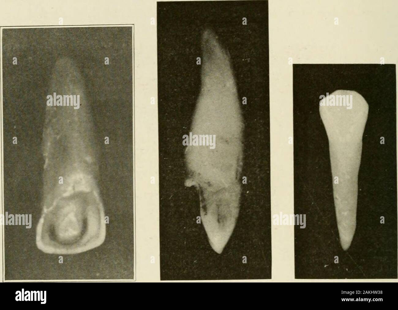 General and dental pathology with special reference to etiology and ...