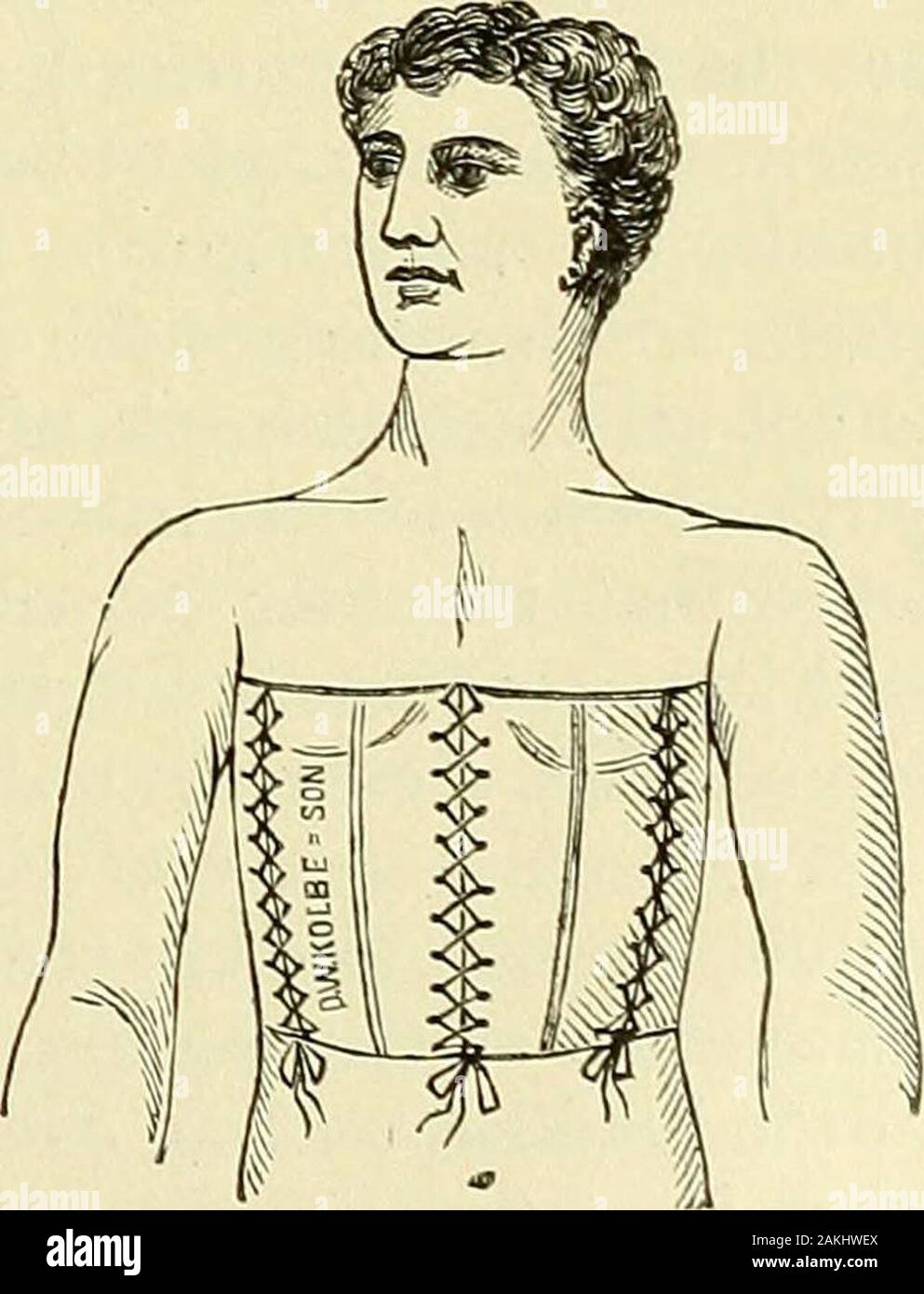 Extension fractures hi-res stock photography and images - Alamy