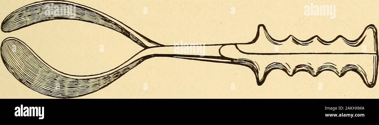 A nurse's handbook of obstetrics, for use in training-schools . Fig. 77 ...