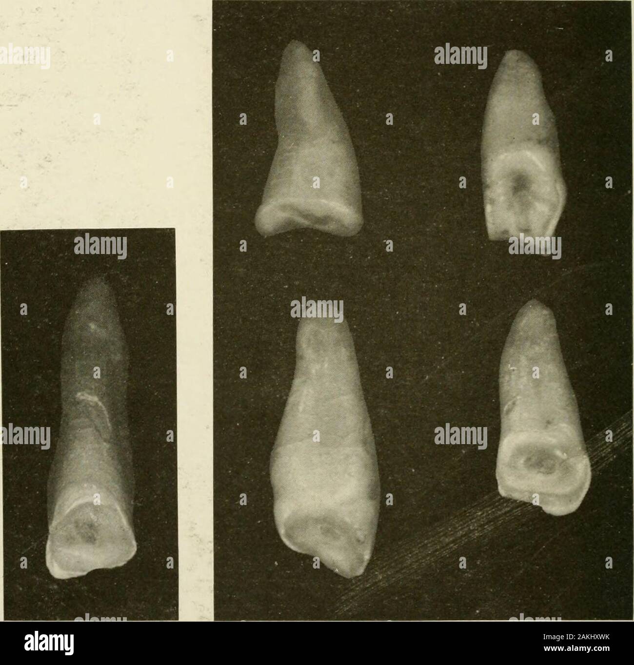 General and dental pathology with special reference to etiology and ...