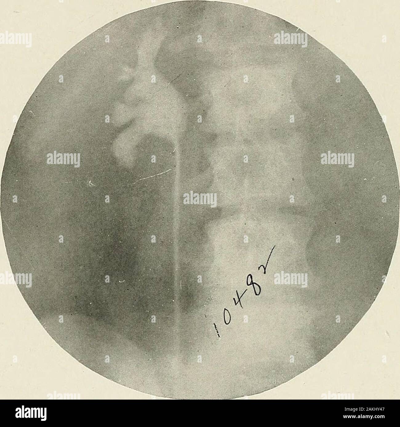 Pyelography (pyelo-ureterography) a study of the normal and pathologic ...