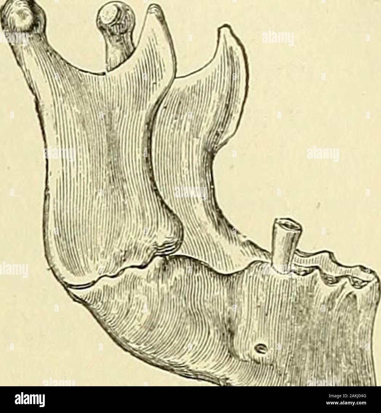 Inferior maxillary bone hi-res stock photography and images - Alamy