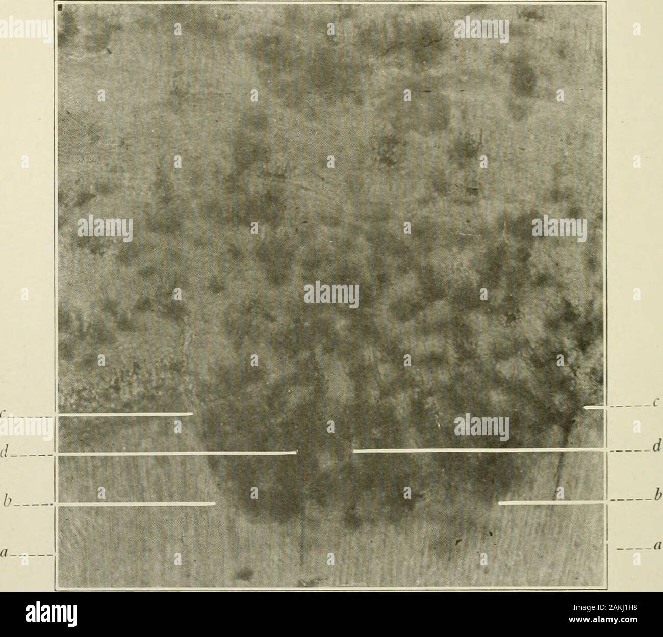 Apical foramen of root of tooth hi-res stock photography and images - Alamy