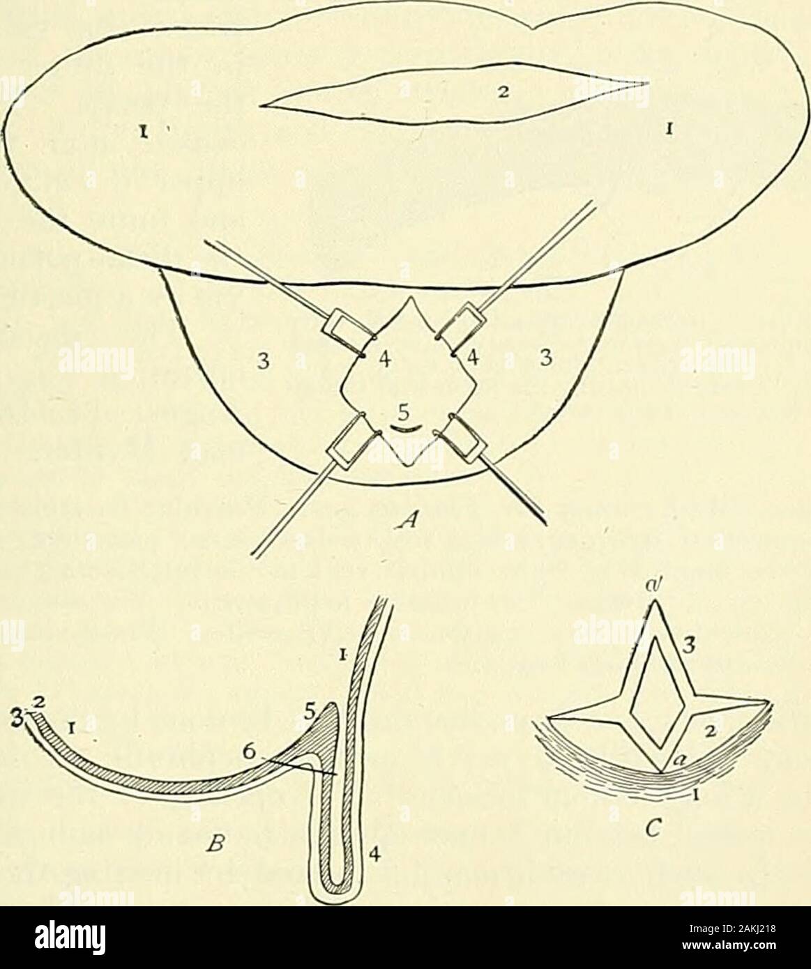 Skin traction hi-res stock photography and images - Alamy