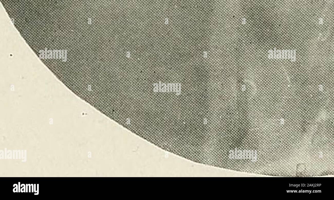 Pyelography (pyelo-ureterography) a study of the normal and pathologic ...