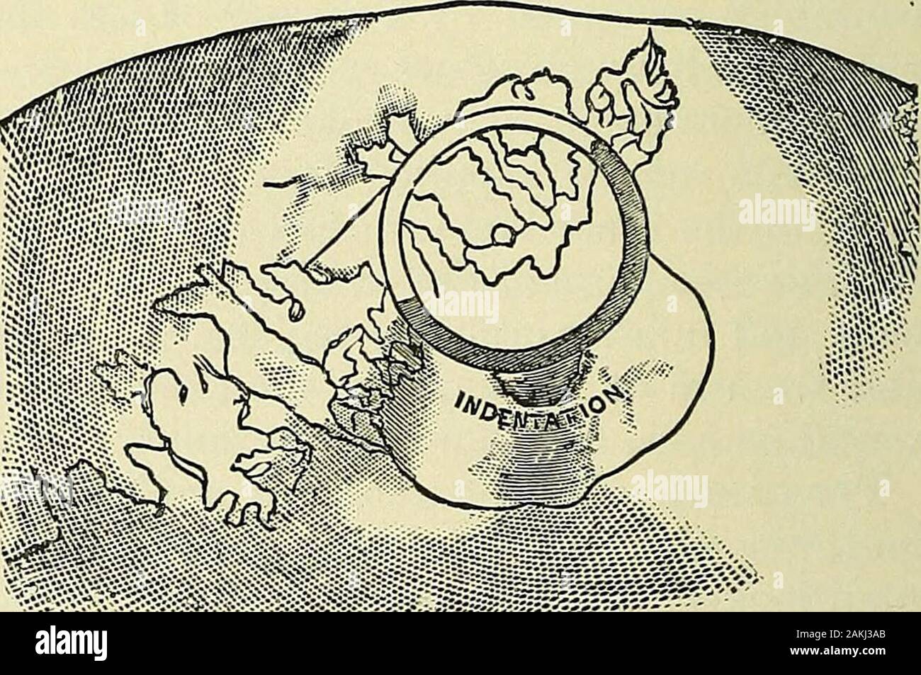 A manual of modern surgery : an exposition of the accepted doctrines ...