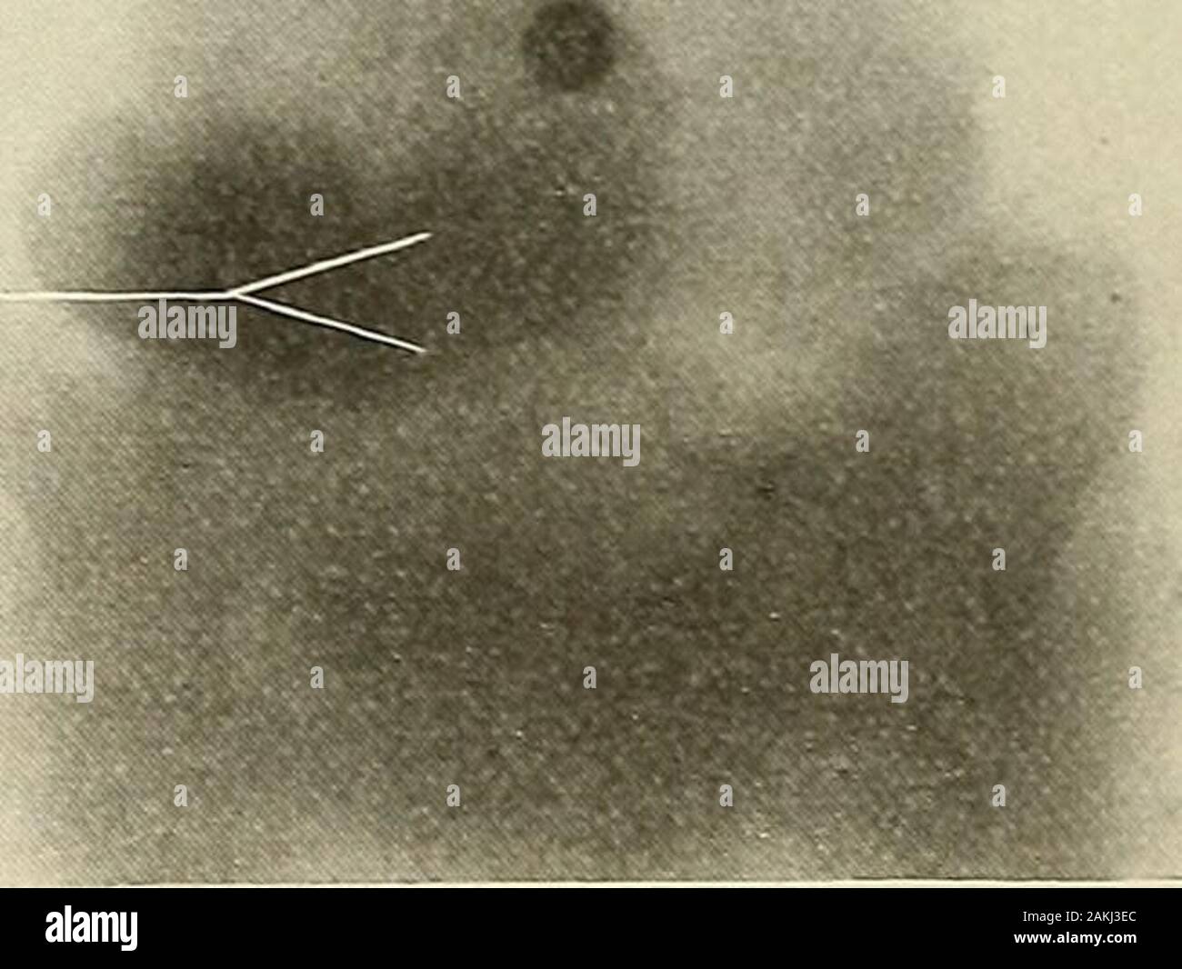 Skiagraphy hi-res stock photography and images - Alamy