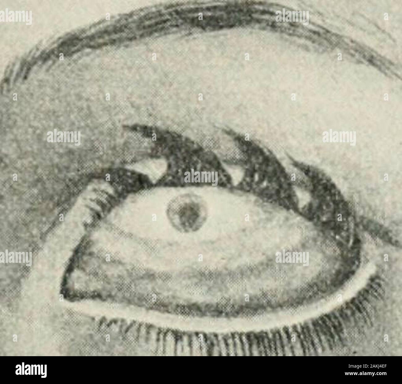 Transactions . Dr. Geo. Mackays case of congenital microphthalmos and ...