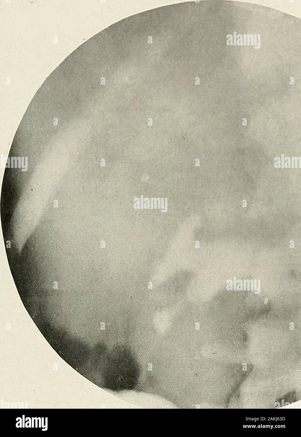 Pyelography (pyelo-ureterography) a study of the normal and pathologic ...