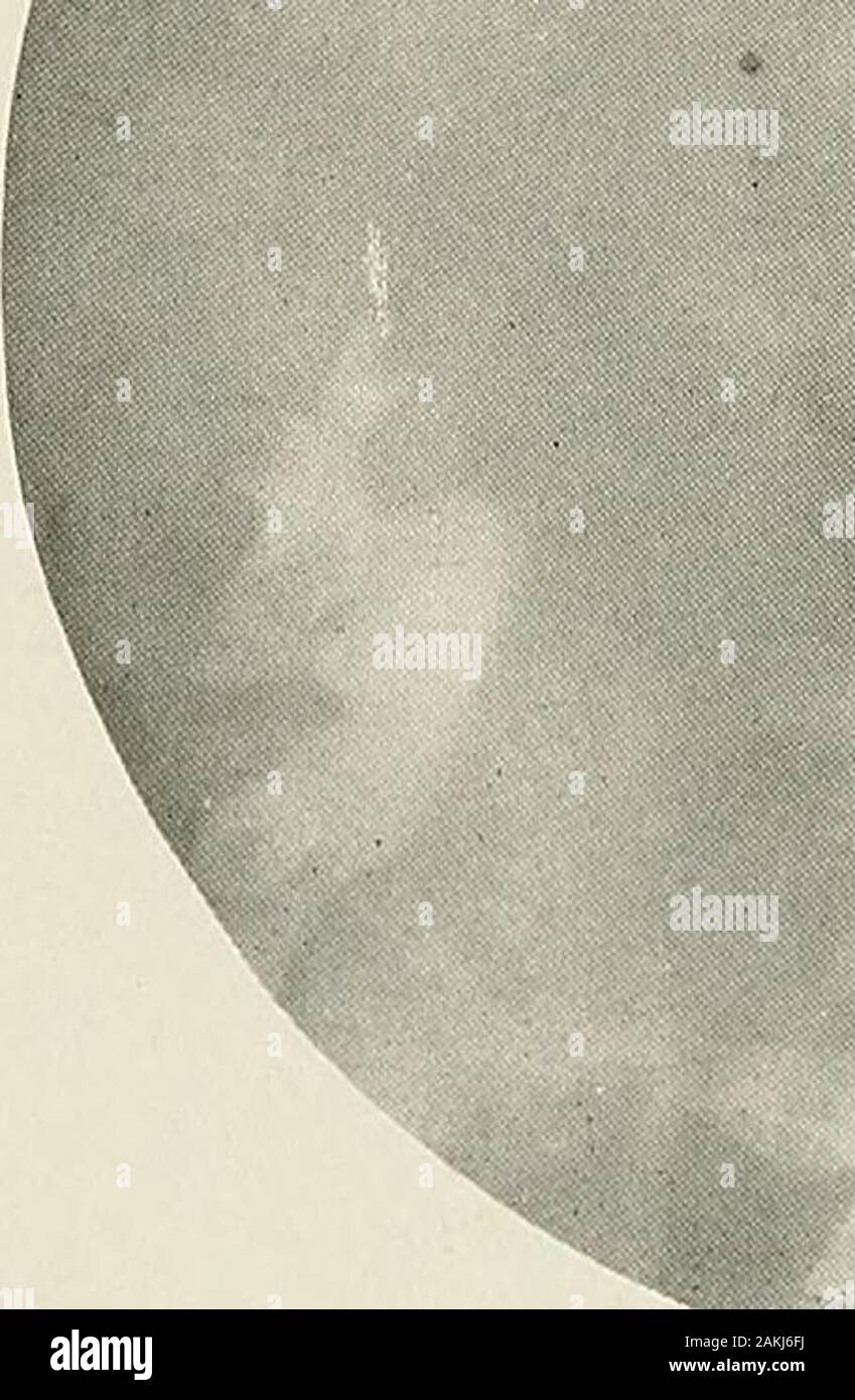 Pyelography (pyelo-ureterography) a study of the normal and pathologic ...