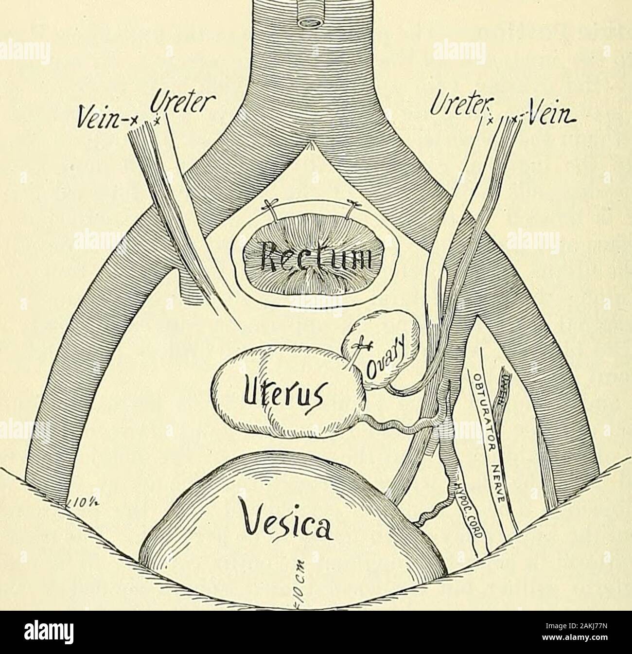 Renal Artery Cadaver
