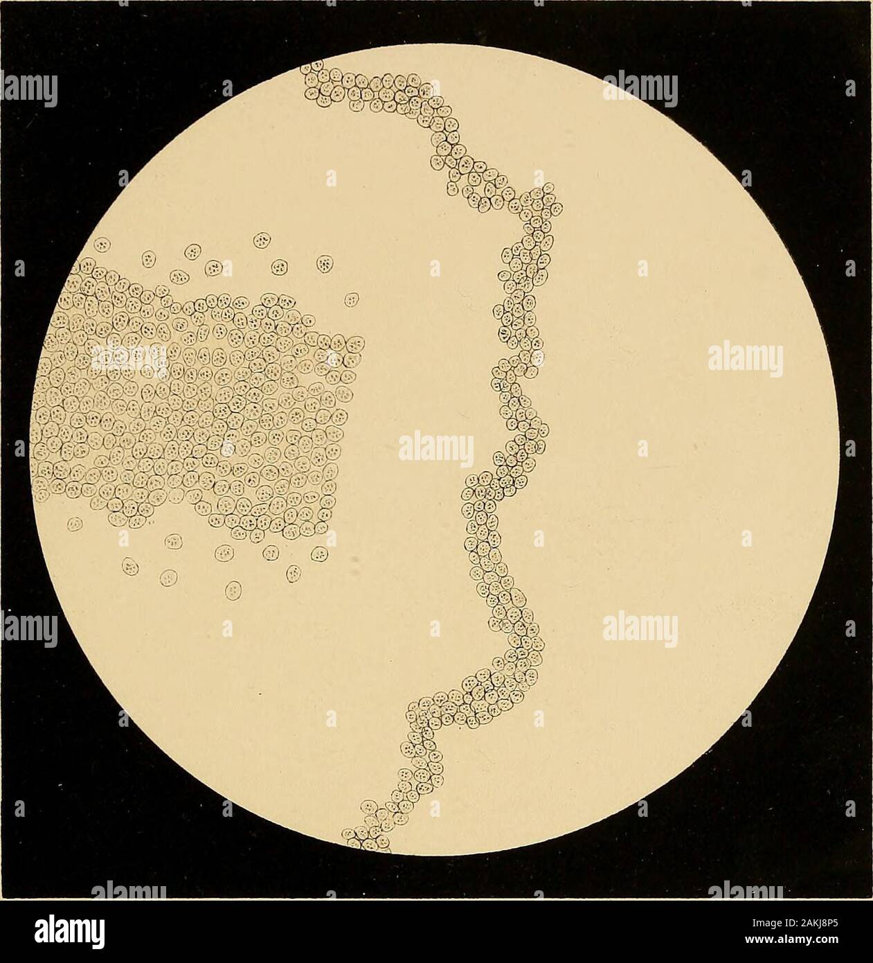 Zit Pus Under Microscope