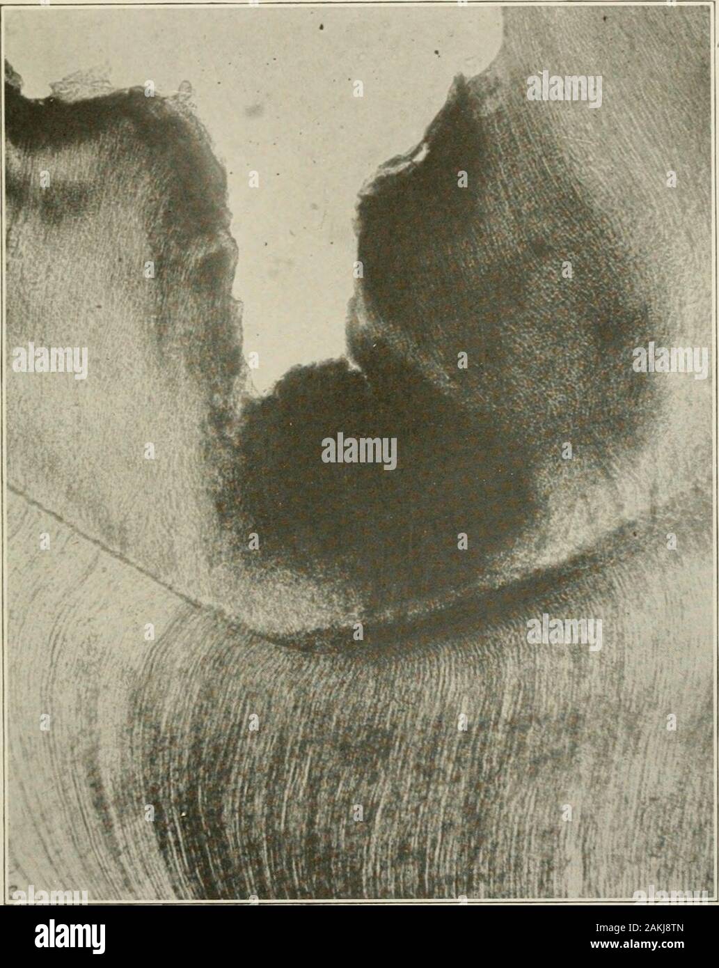 General and dental pathology with special reference to etiology and ...