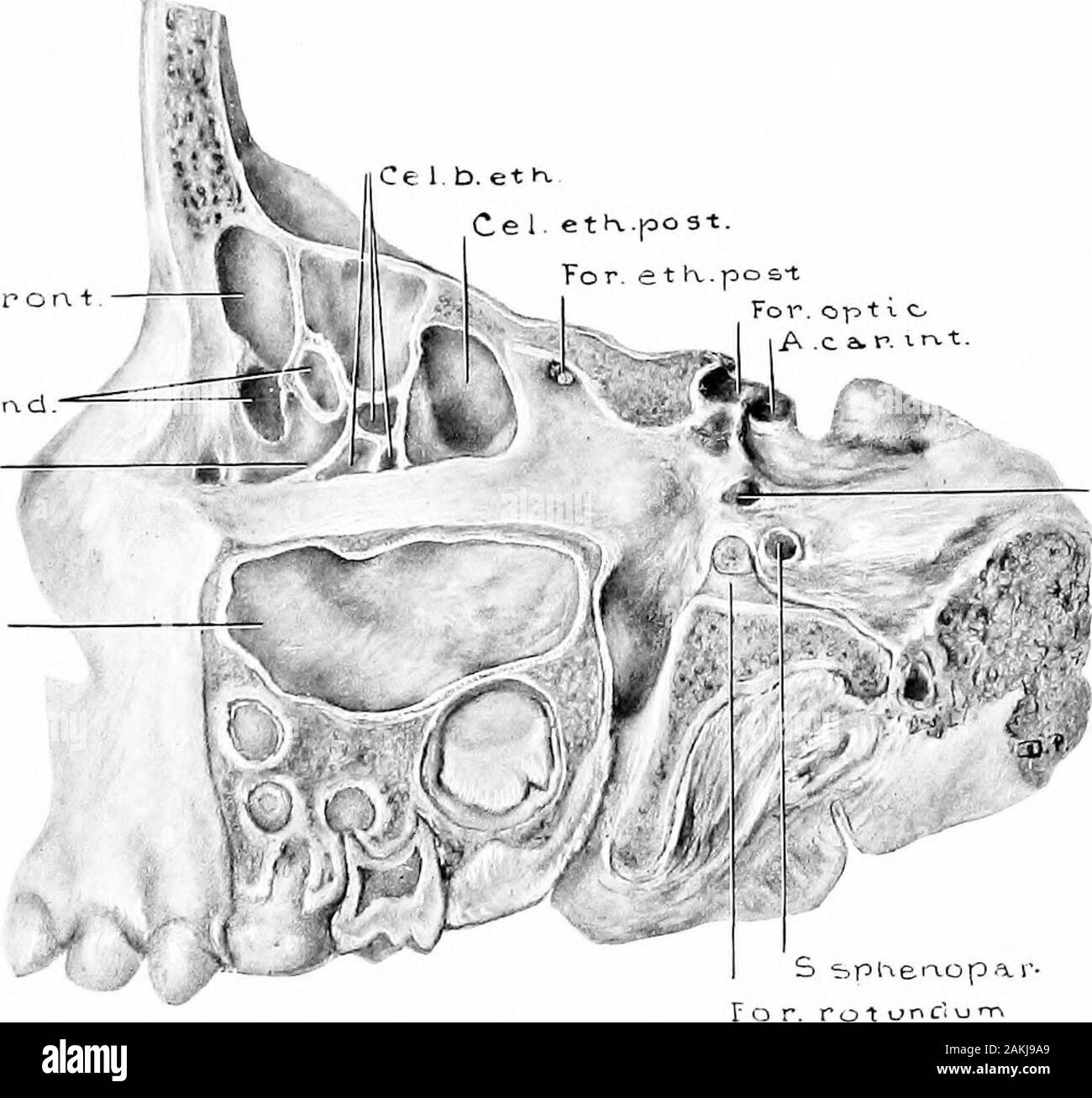 Development and anatomy of the nasal accessory sinuses in man ...