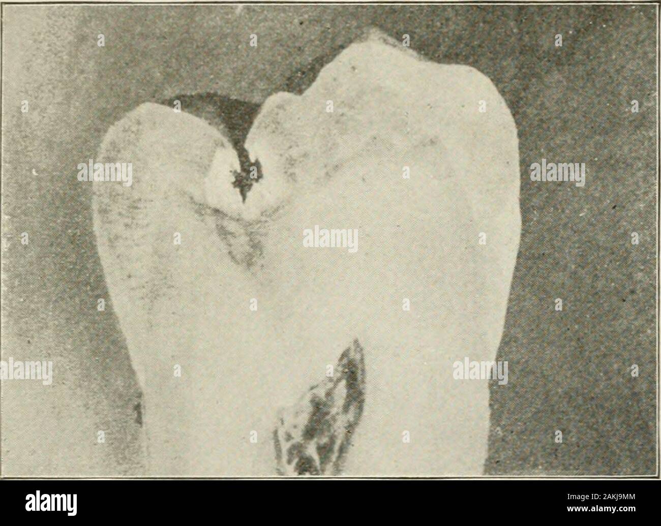 Enamel rods hi-res stock photography and images - Alamy