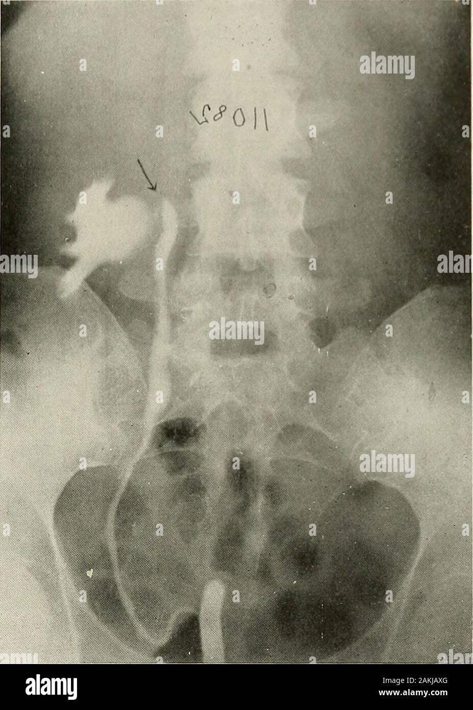 Bony pelvis hi-res stock photography and images - Alamy