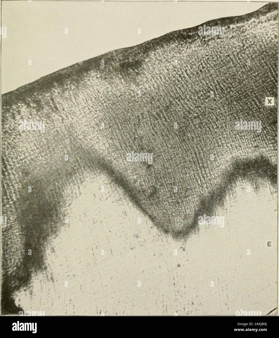 The tooth surfaces hi-res stock photography and images - Alamy