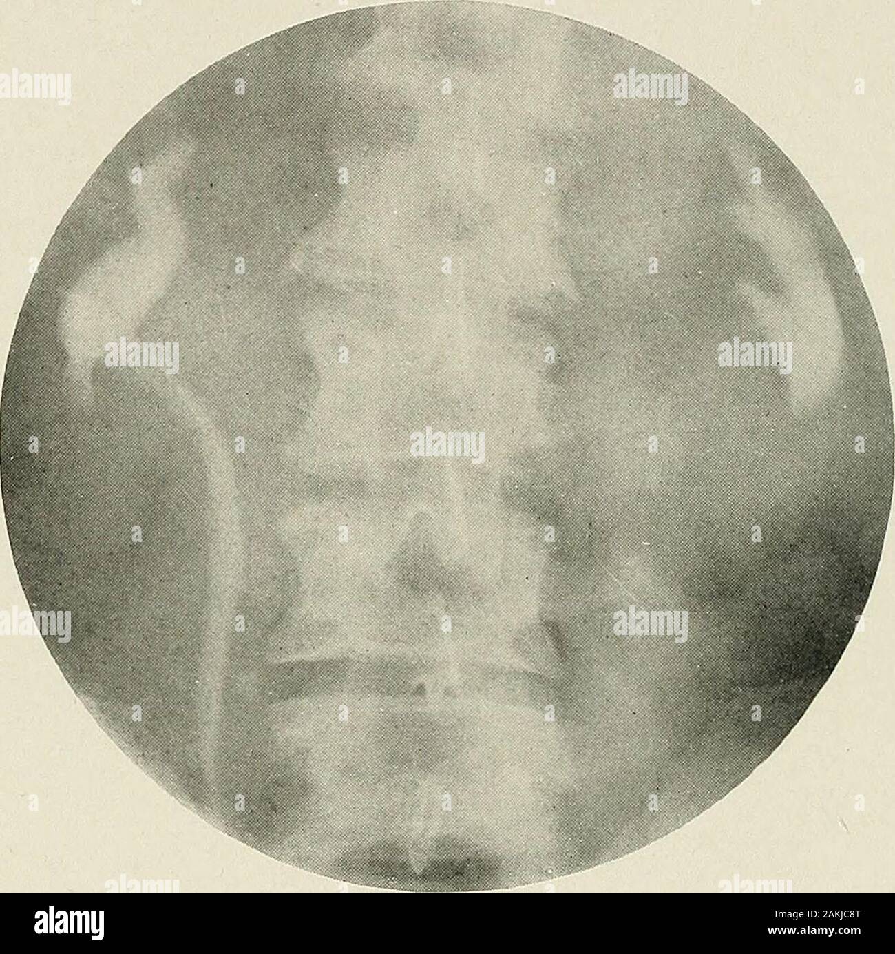 Pyelography (pyelo-ureterography) a study of the normal and pathologic ...