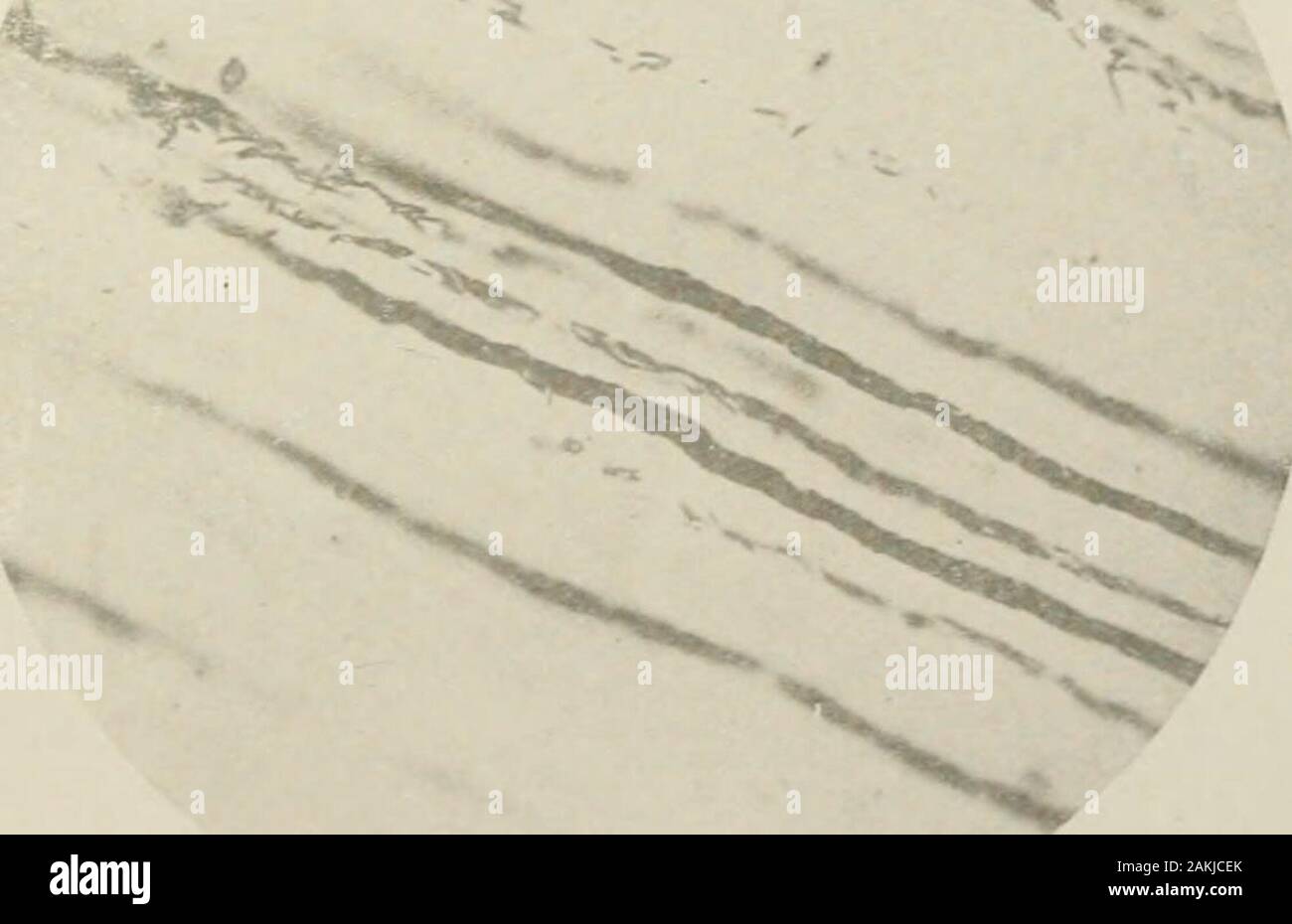 Dentin matrix hi-res stock photography and images - Alamy